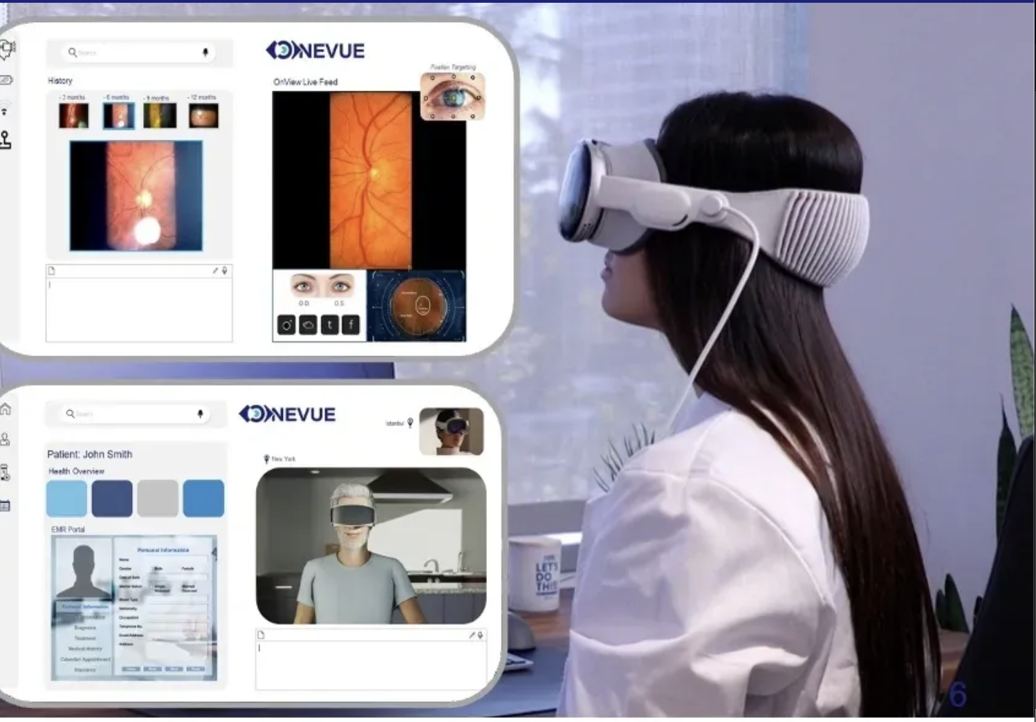 OneVue - Revolutionary Eye Imaging Technology