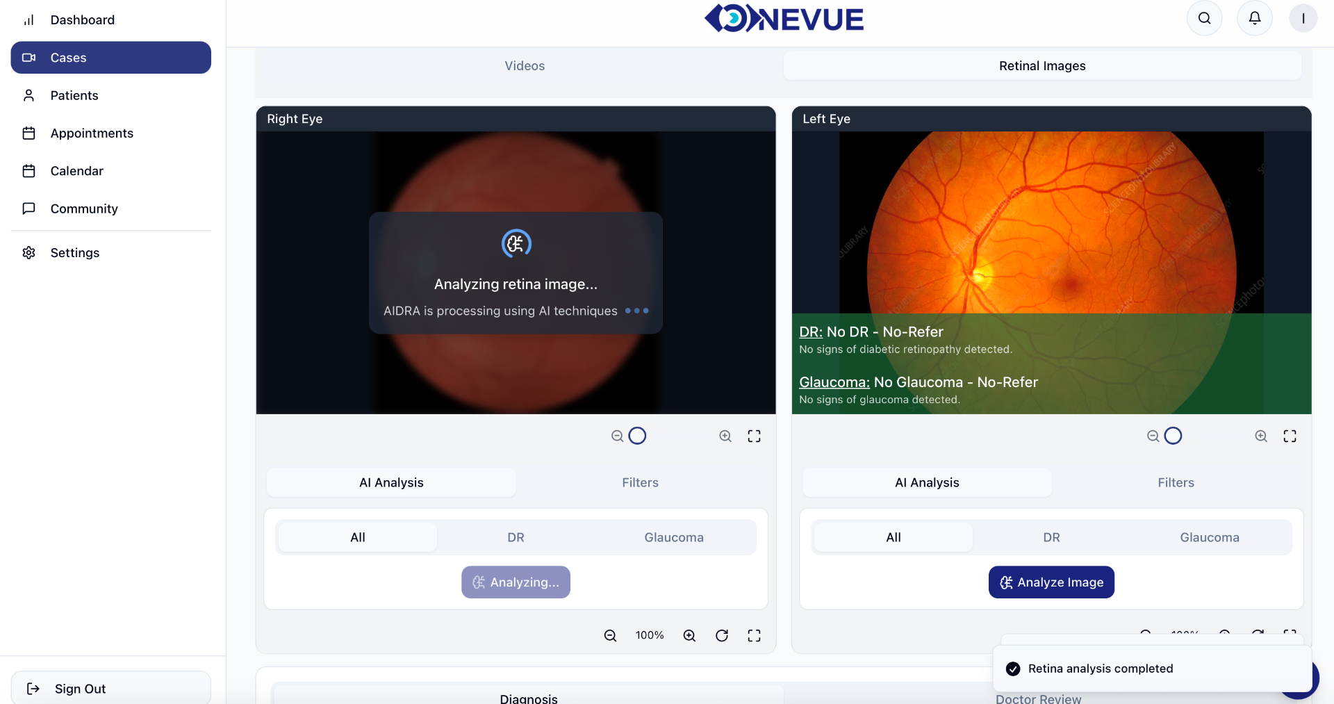 OneVue - Revolutionary Eye Imaging Technology